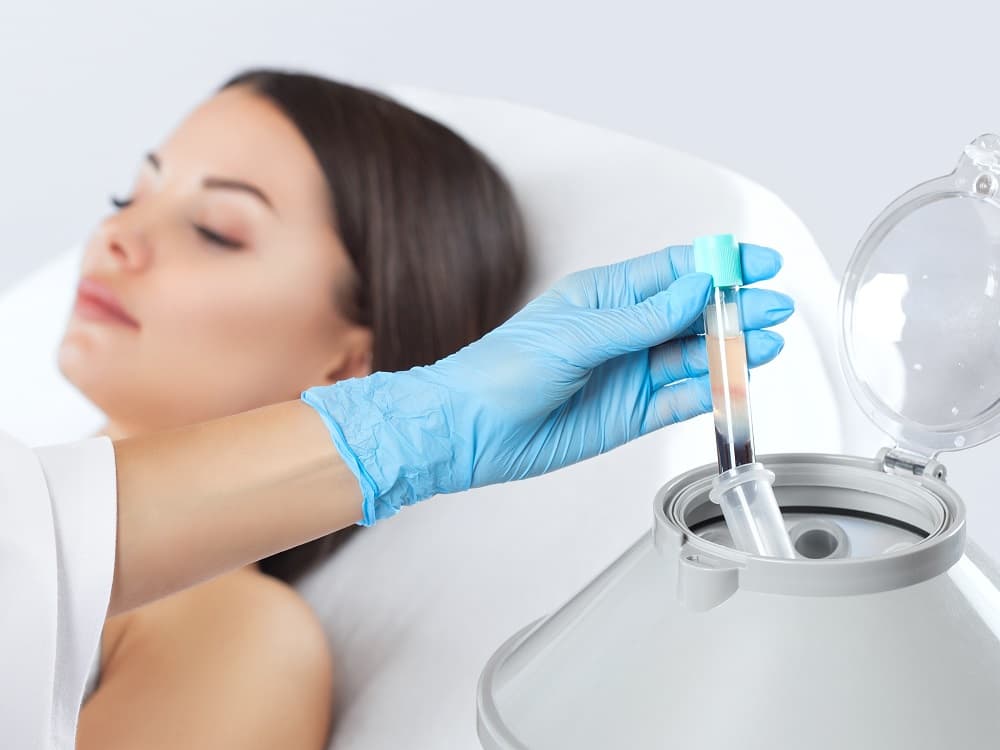 Everything You Need to Know About PRP Treatments - JohnsonCountyChamber